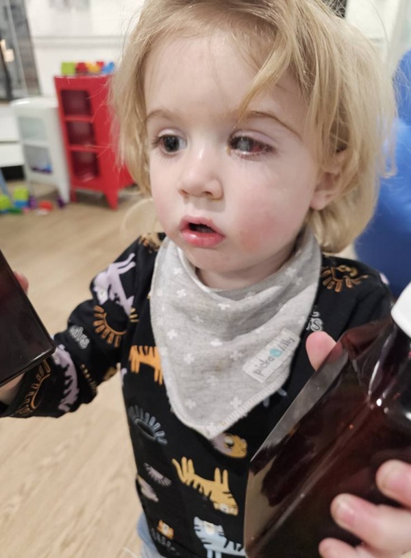 Ce tragedie! Un copil de 2 ani și-a pierdut vederea | Qbebe.ro